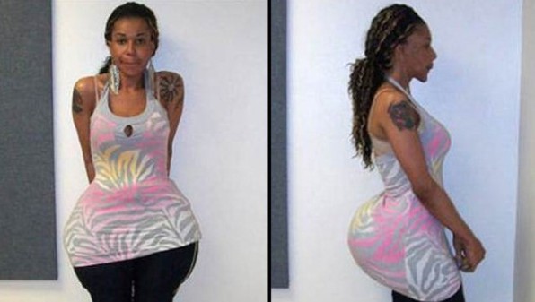 Sporting a Caribbean Big Butt could kill you - CaribDirect